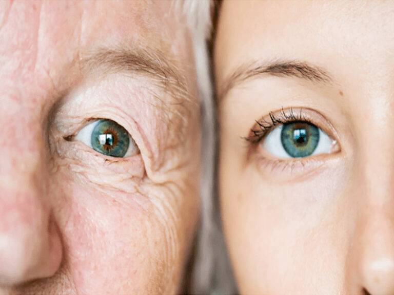 Beware! Hereditary disorders can tweak your eye health, impacting ...